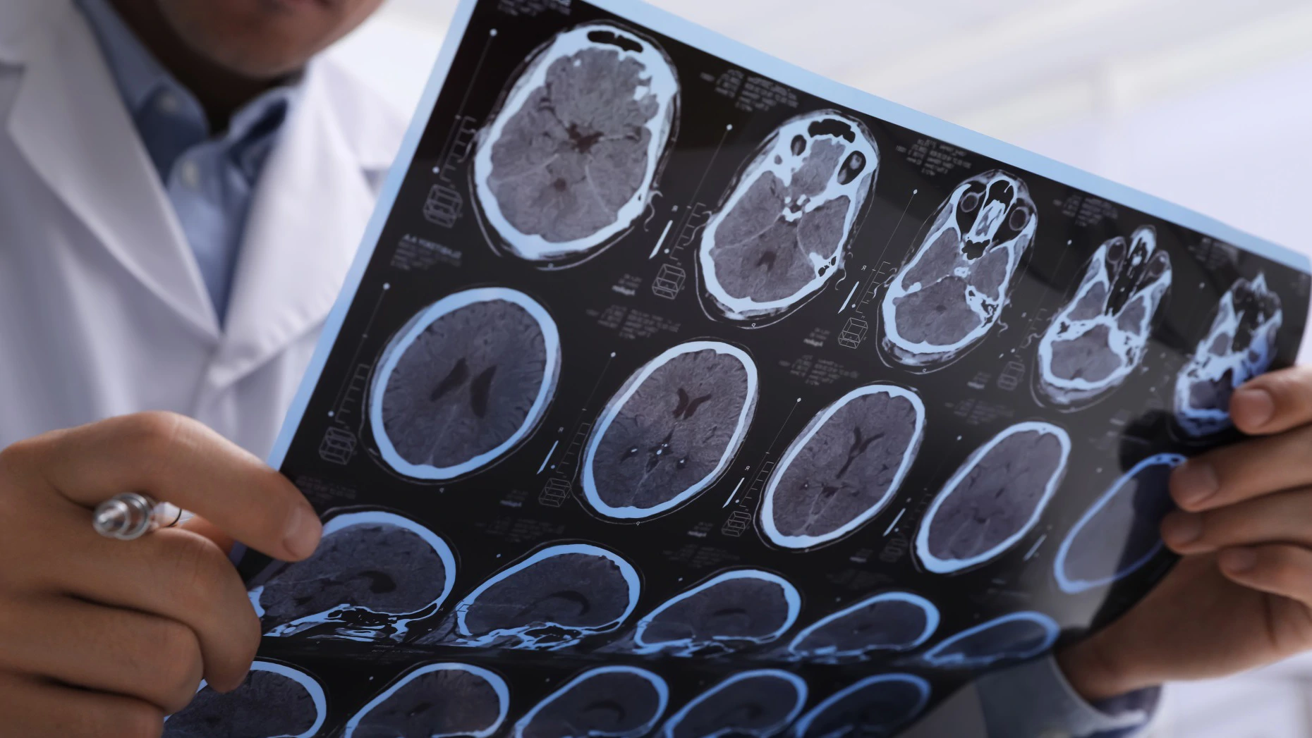 Zovi doktora: Pacijenti s epileptičnim napadajima svaki dan na hitnoj - HRT
