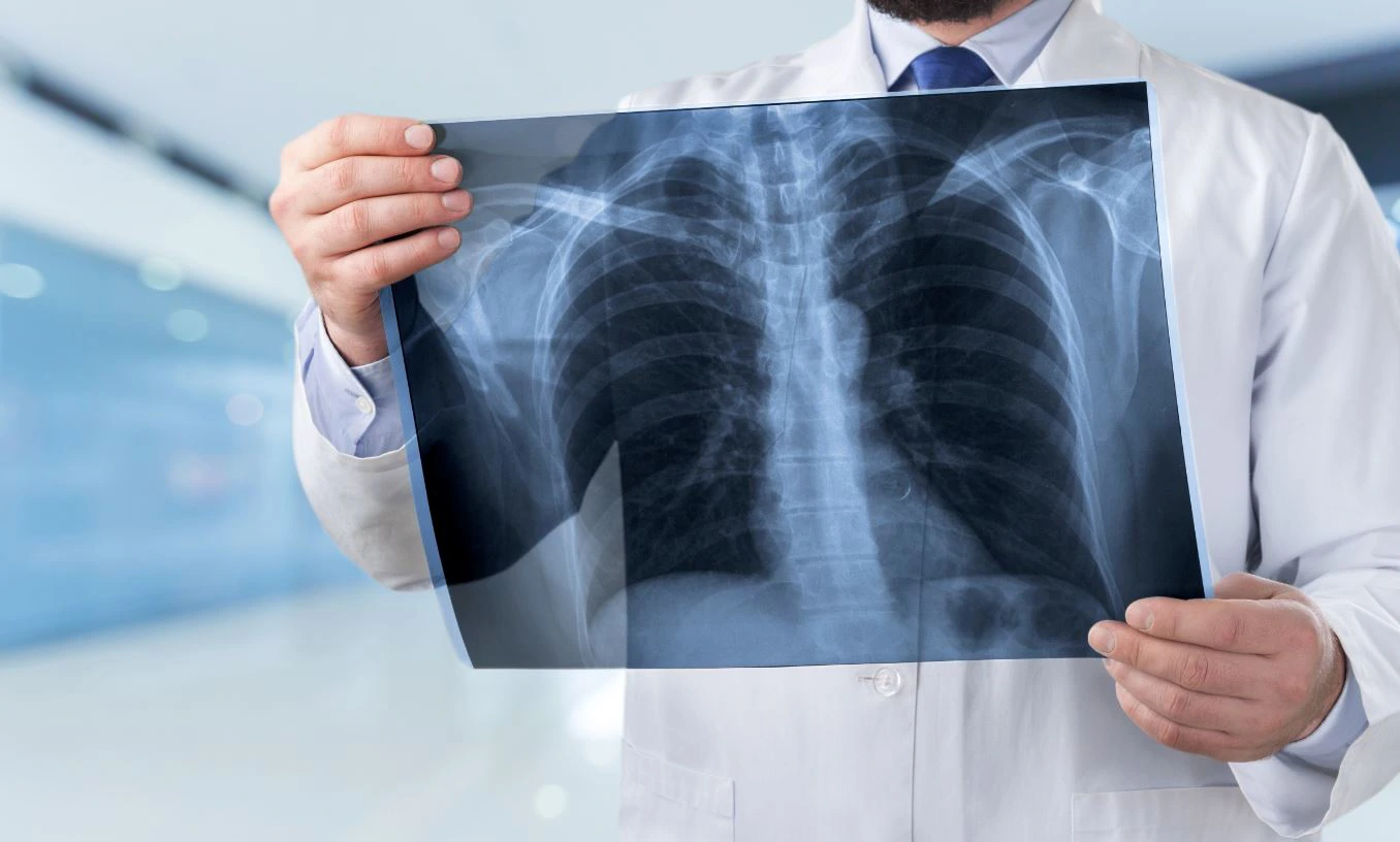 Tuberkuloza, najsmrtonosnija zarazna bolest - HRT