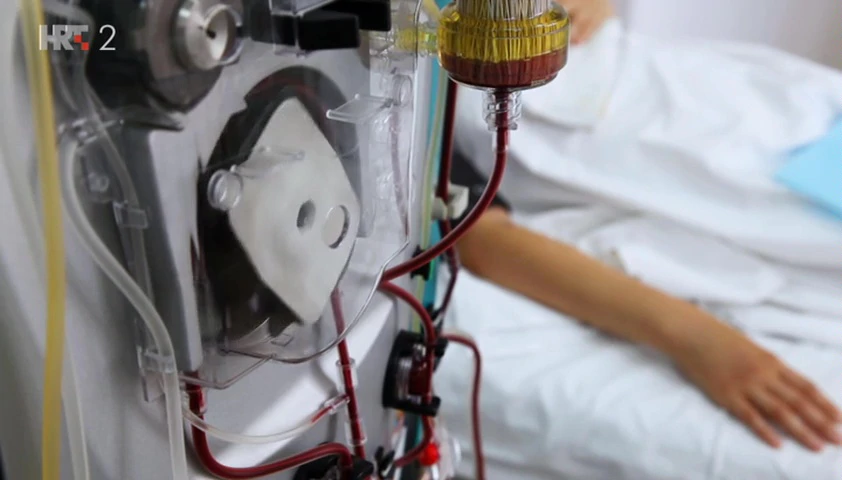 Leukemija: prognoza bolesti danas je neizmjerno bolja nego prije 30 ...