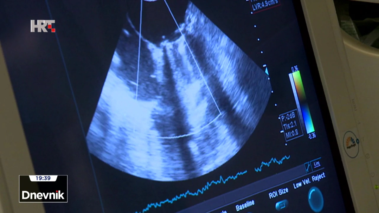 U samo devet dana u KBC-u Zagreb transplantirali devet organa - HRT
