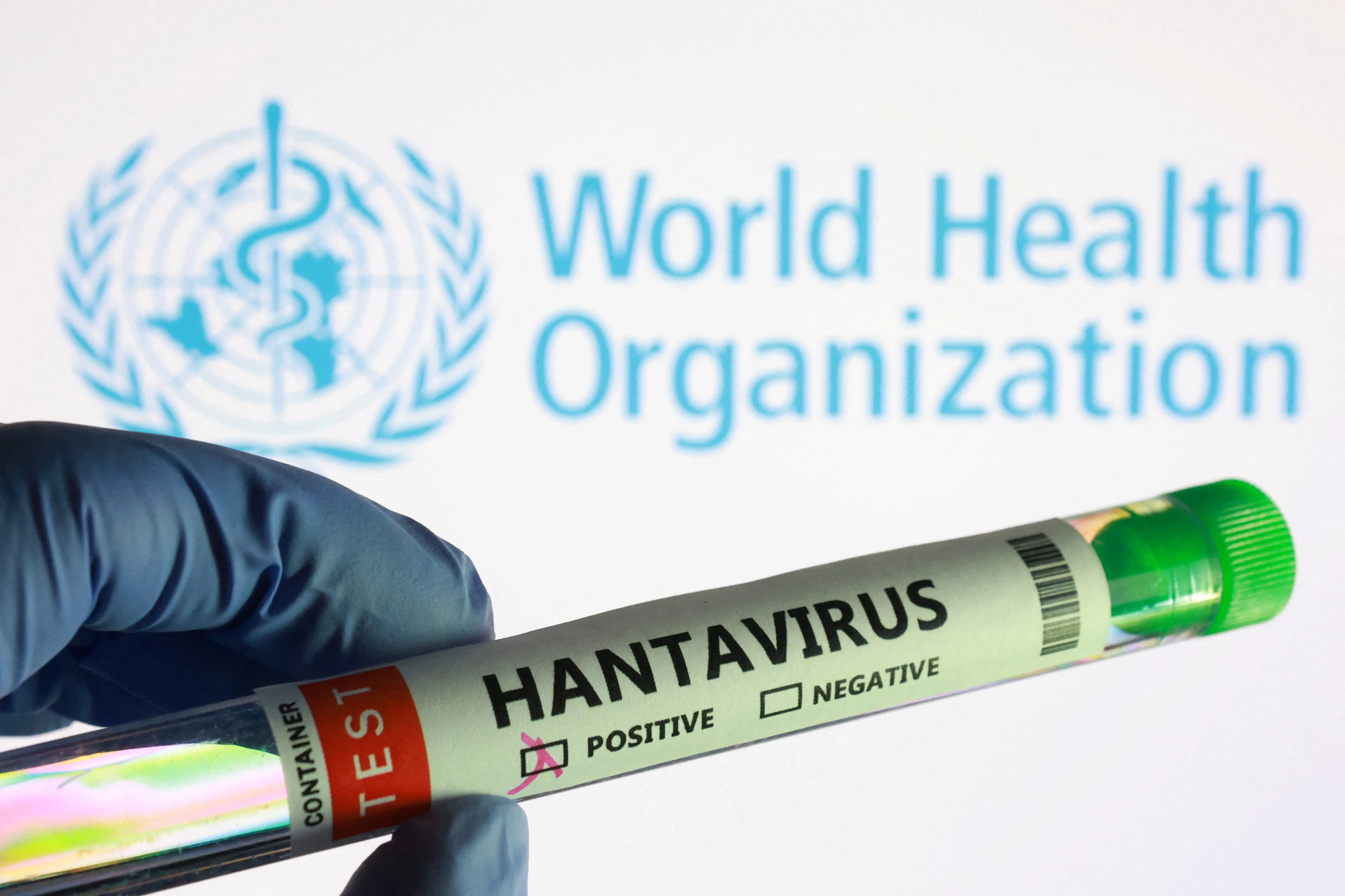 WHO o hantavirusu: Ovo nije početak ni epidemije ni pandemije - HRT