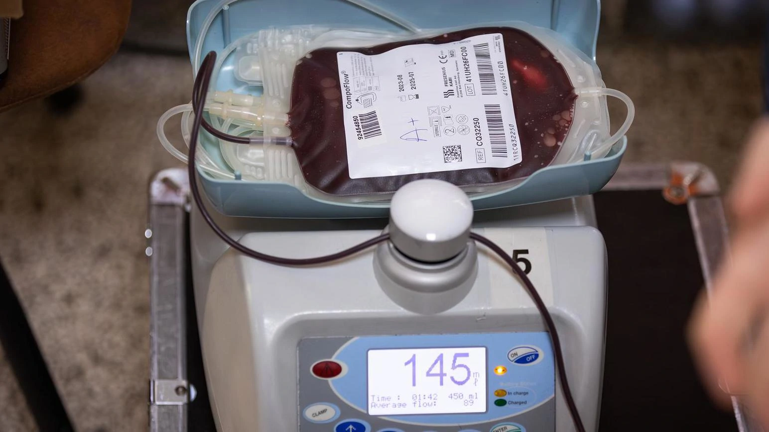 Ljetna nestašica krvi: KBC Rijeka hitno treba A+ darivatelje - HRT